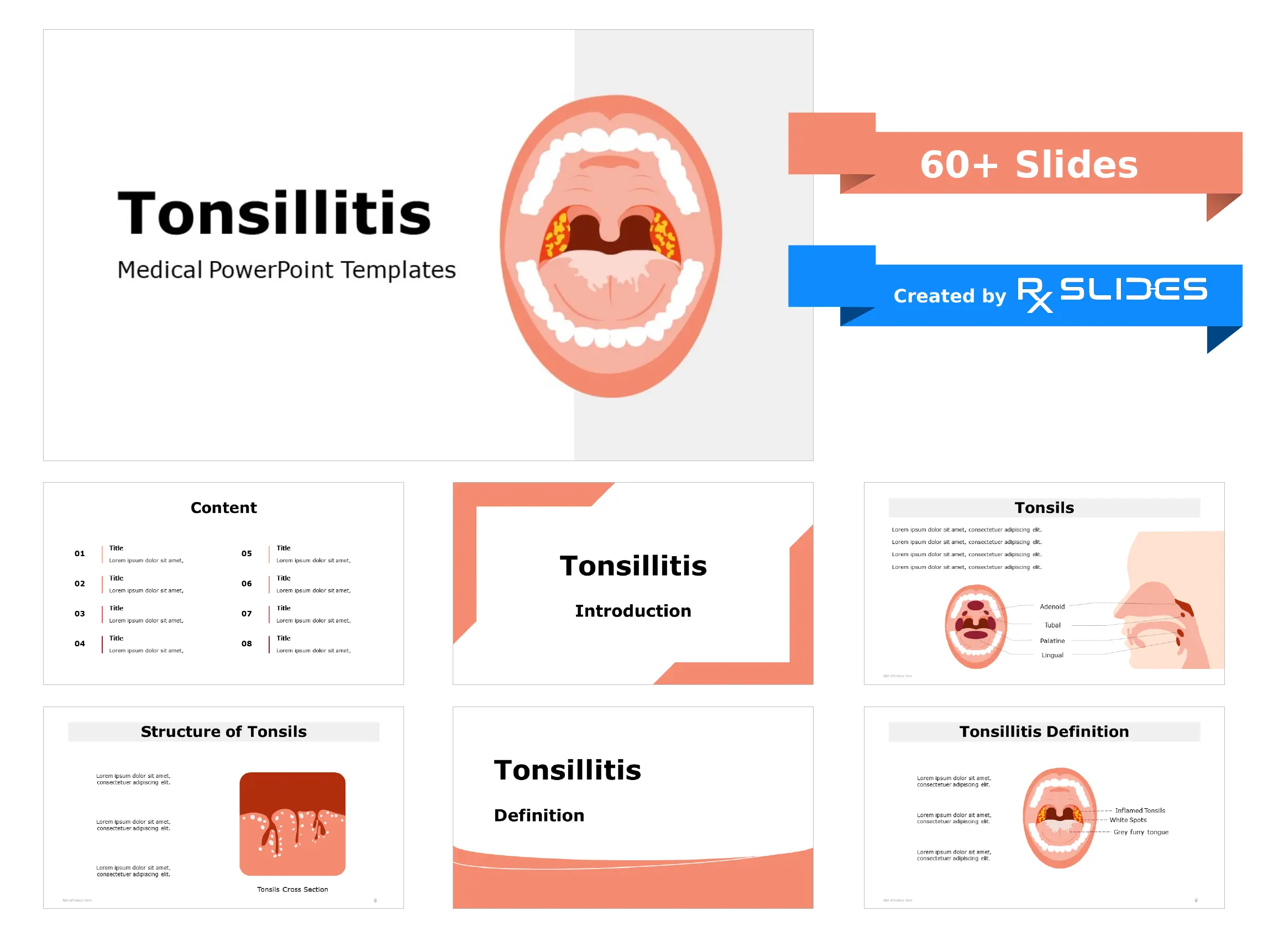 Download Tonsillitis PowerPoint Template| RxSlides